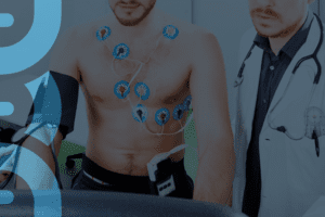 Teste ergométrico ou teste de esforço: o que devo fazer?